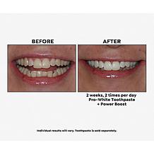 intelliWHiTE | Shop Teeth Whitening Kits, Toothpaste & Toothbrushes | HSN