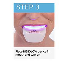 intelliWHiTE | Shop Teeth Whitening Kits, Toothpaste & Toothbrushes | HSN