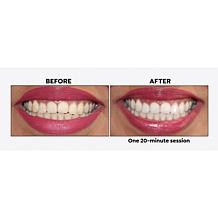 intelliWHiTE | Shop Teeth Whitening Kits, Toothpaste & Toothbrushes | HSN