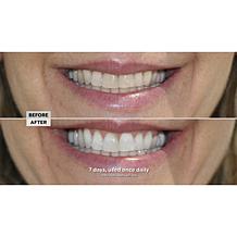 intelliWHiTE | Shop Teeth Whitening Kits, Toothpaste & Toothbrushes | HSN
