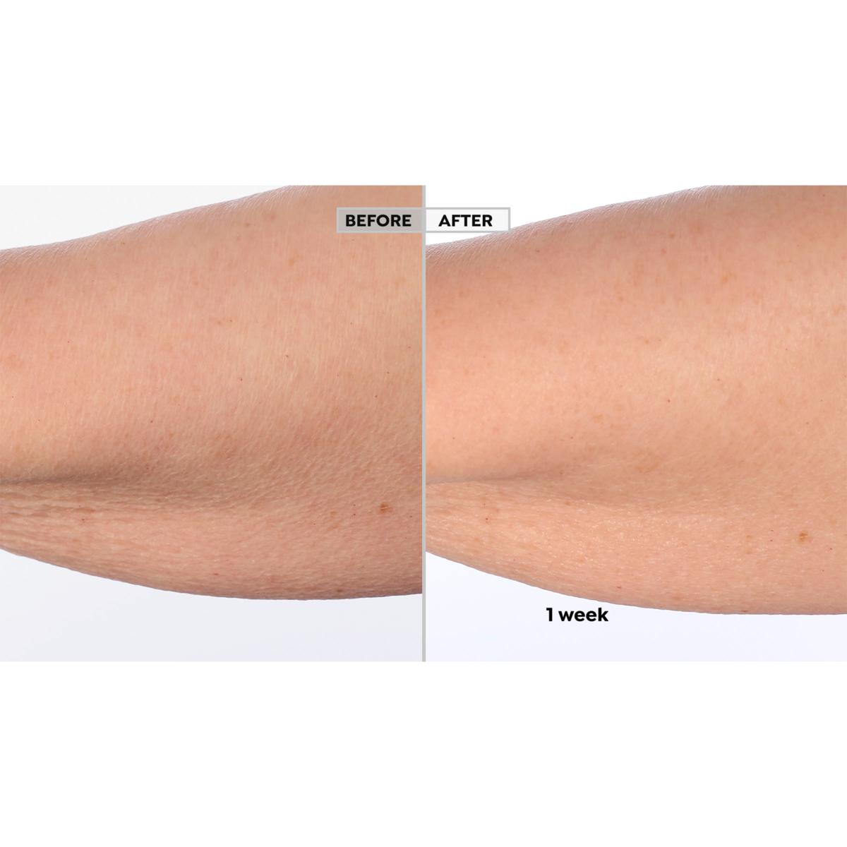 (HSN) Nakery Beauty Smooth + Restore Skin Renewal 4-pc Collection with ...